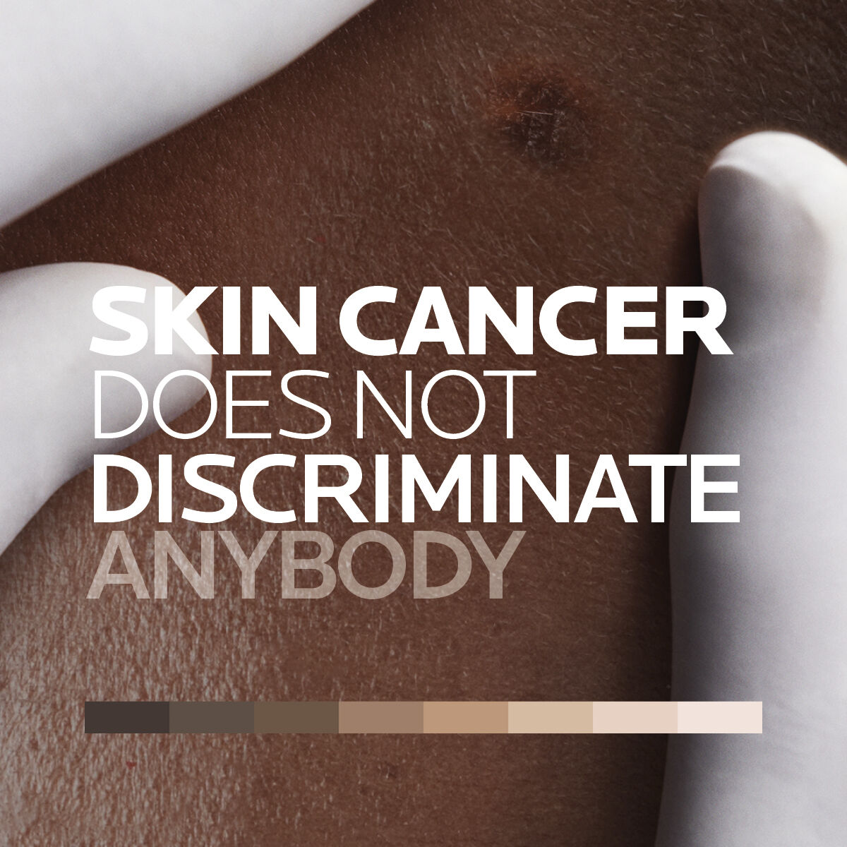 How to Conduct a Skin Mole Check | La Roche-Posay Australia